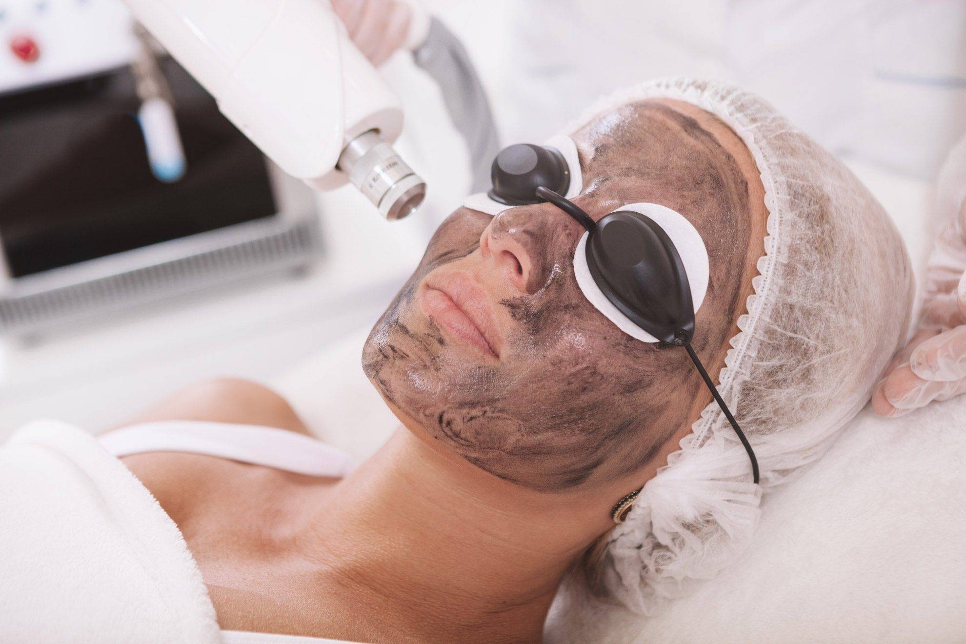 Carbon Facial | Rasaderm